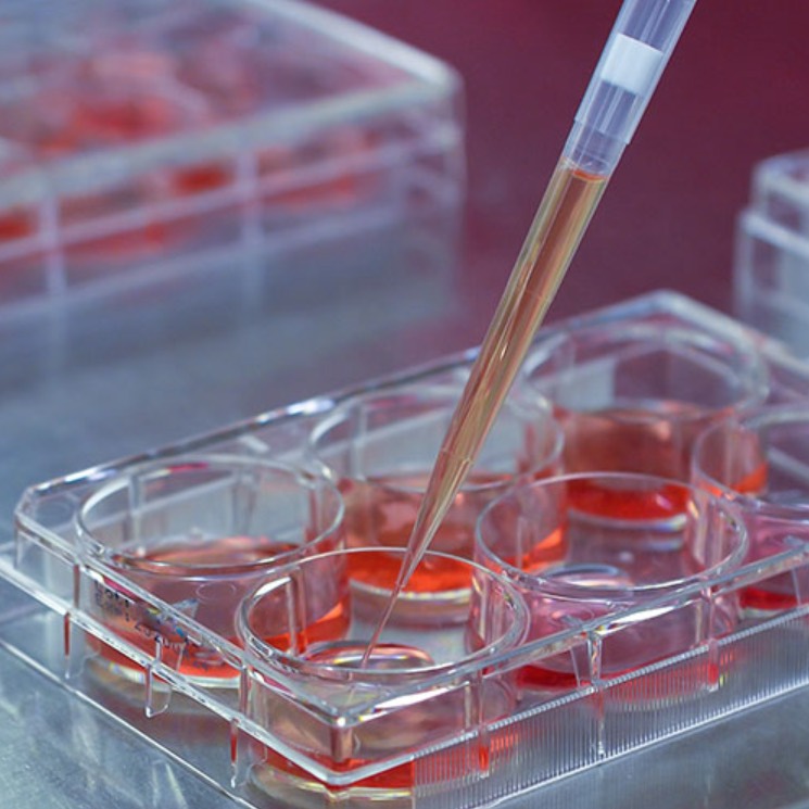 Sérologies SARS-CoV-2 COVID19, pourquoi ? Chez qui ? - Atoute.org